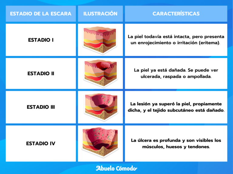 Úlceras por presión: estas son las complicaciones que pueden presentar